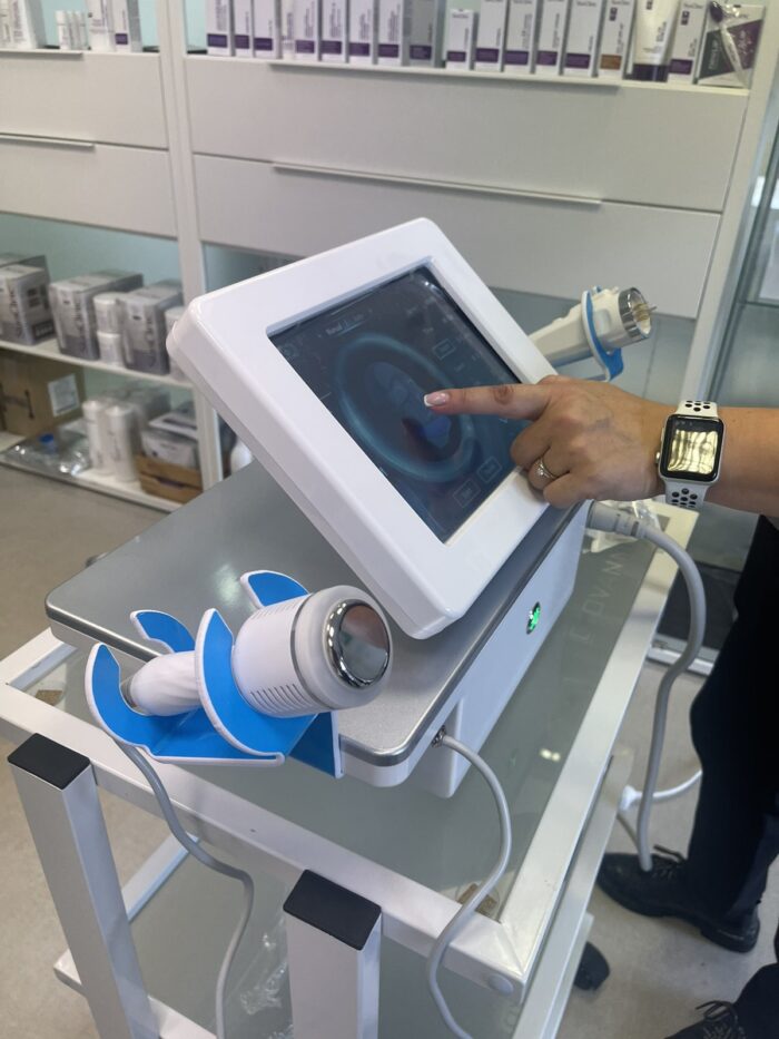 Fractional microneedle radiofrequency with cryo tip for face and body ...